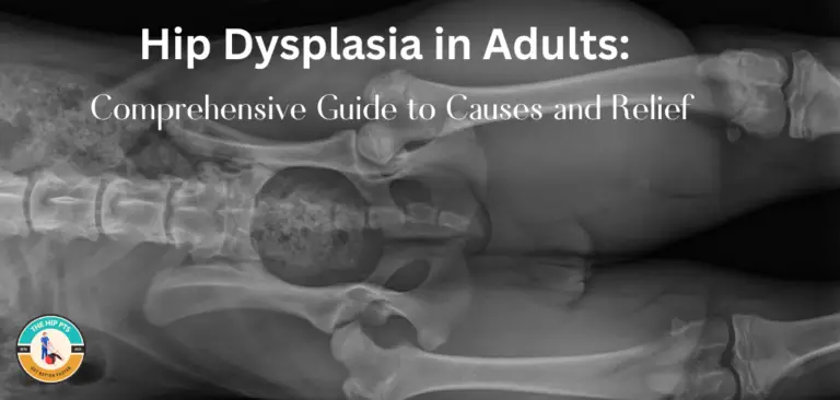 Hip Dysplasia in Adults: Comprehensive Guide to Causes and Relief - The ...